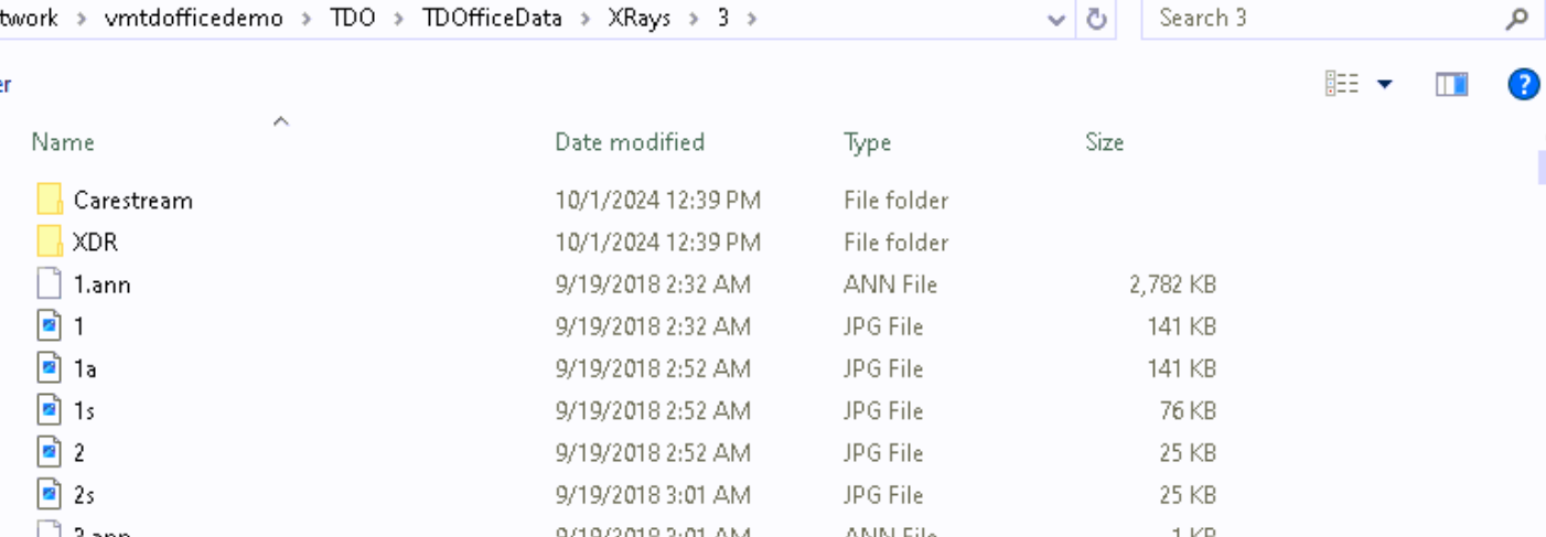 How to retrieve an X-ray not saved when using Carestream or XDR ...