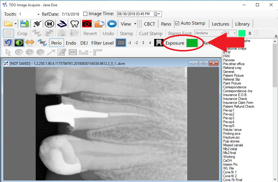 Configuring Carestream SDK and Troubleshooting X-ray Image Quality in ...
