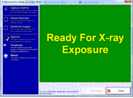 Optime -installation guide